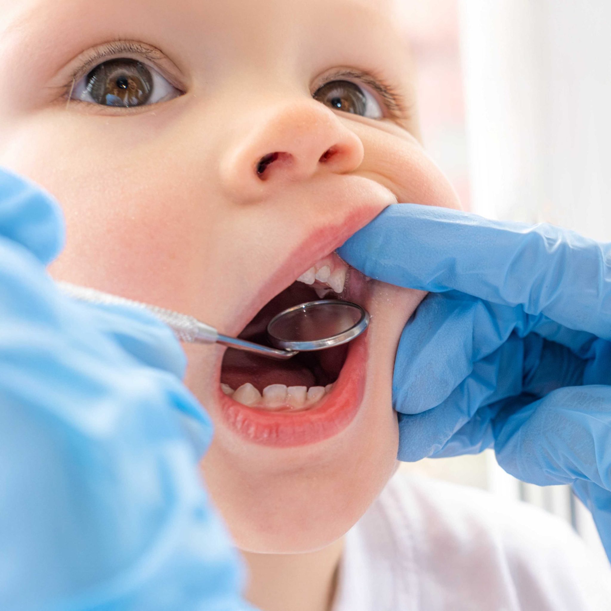 What Does It Mean When a Dentist Says They’re “Watching” a Tooth ...